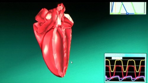Real-time heart beat simulator visualizes pulsation and disease on a ...