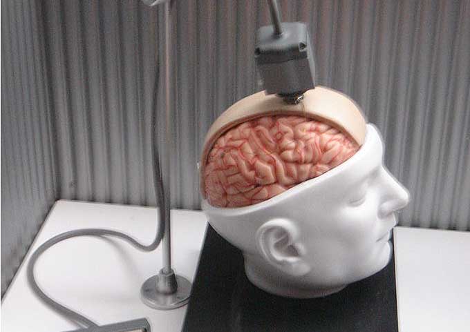 The gateway to advanced neuroprosthetics: Jessica Feldman talks ...