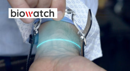 Biowatch: Biometric Identification Using Veins - Robohub